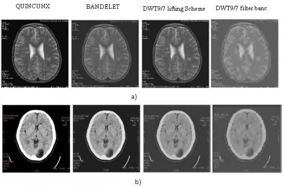 Gray Scale and Color Medical Image Compression by Lifting Wavelet ...